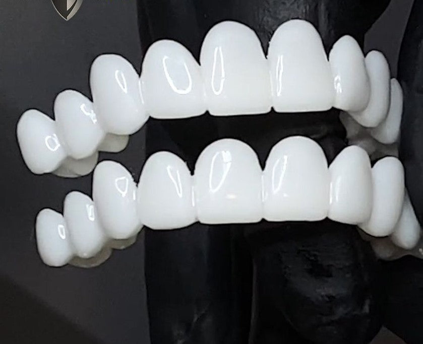 100% Adjustable Whitening Fake Invisible Holeless Braces – sususummer.com